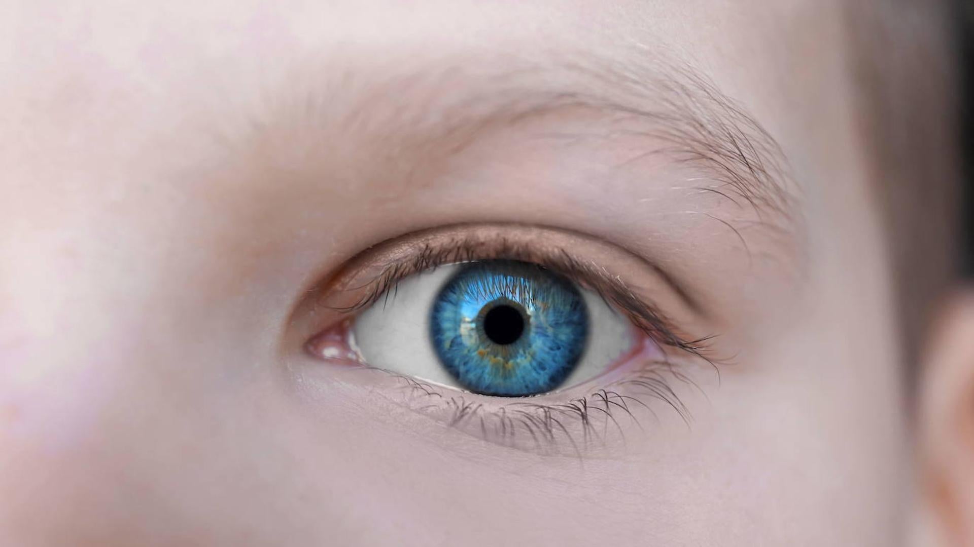La Conjuntivitis En Niños Síntomas Y Qué Hay Que Hacer Para Prevenirla